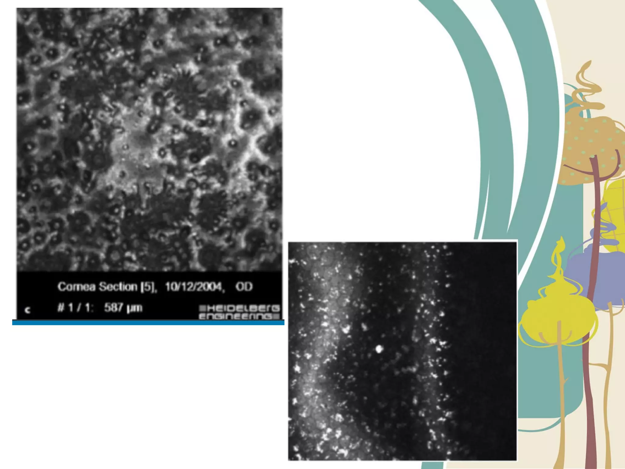 Corneal confocal microscopy | PPT