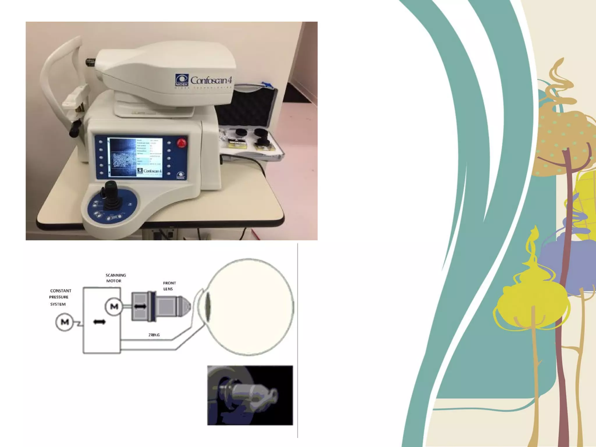 Corneal confocal microscopy | PPT