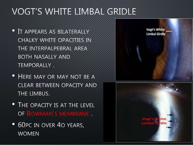 Corneal degenerations
