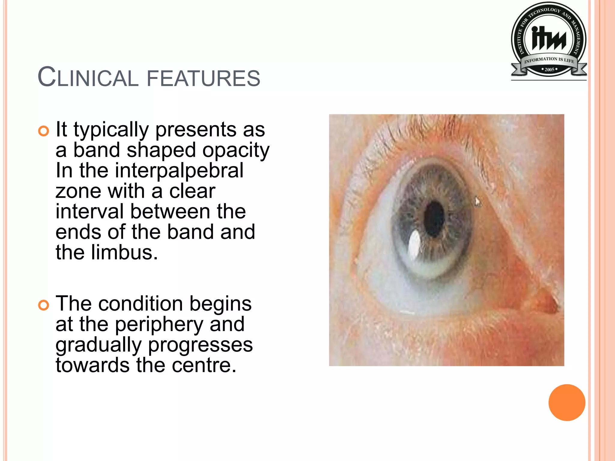 Corneal degeneration ppt | PPTX