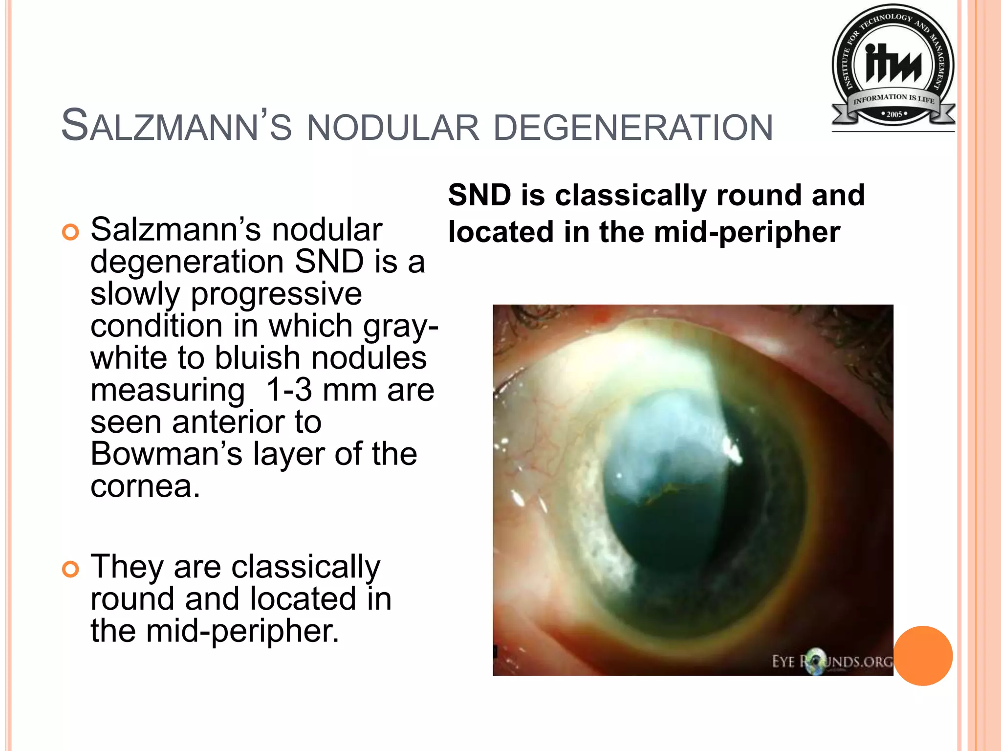 Corneal degeneration ppt | PPTX