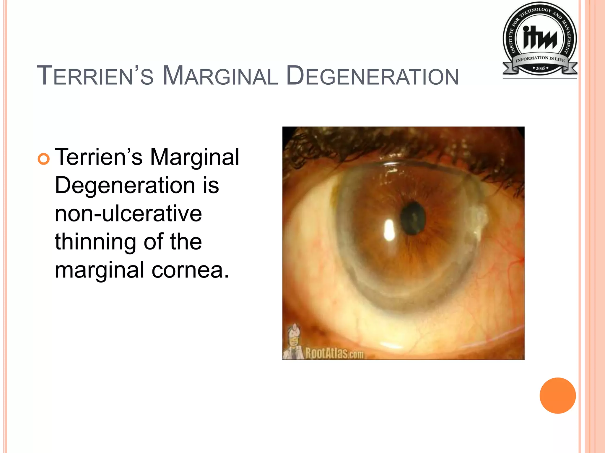 Corneal degeneration ppt | PPTX