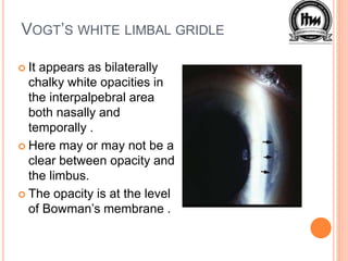 Corneal degeneration ppt | PPTX