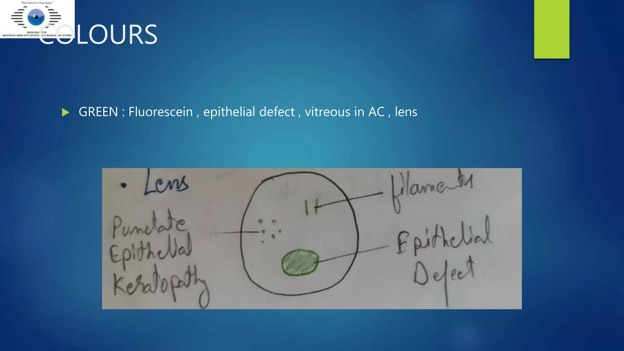 corneal diagrams and colour codes | PPTX