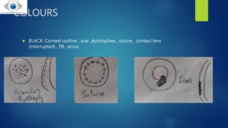 corneal diagrams and colour codes | PPTX
