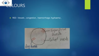 corneal diagrams and colour codes | PPTX