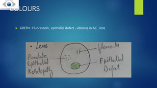 corneal diagrams and colour codes | PPTX
