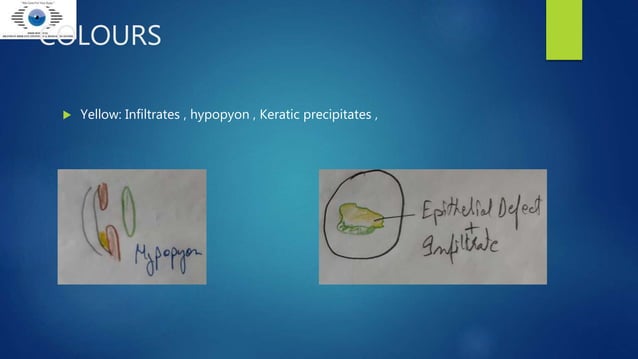 corneal diagrams and colour codes | PPTX