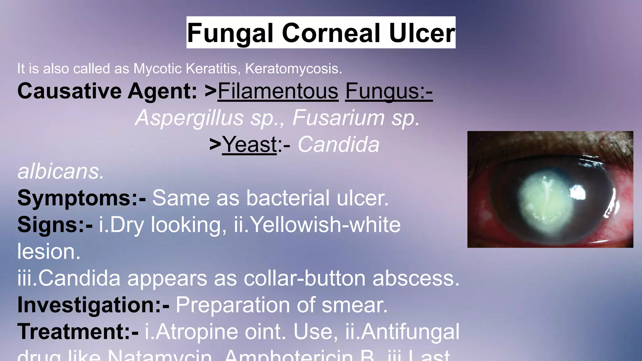 Corneal Disease by Saharukh | PDF