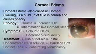 Corneal Disease by Saharukh | PDF