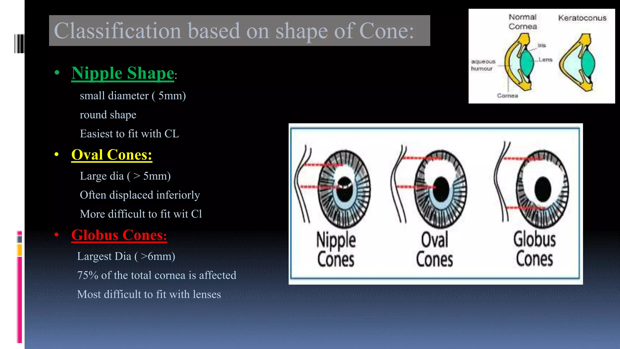 Corneal diseases | PPTX
