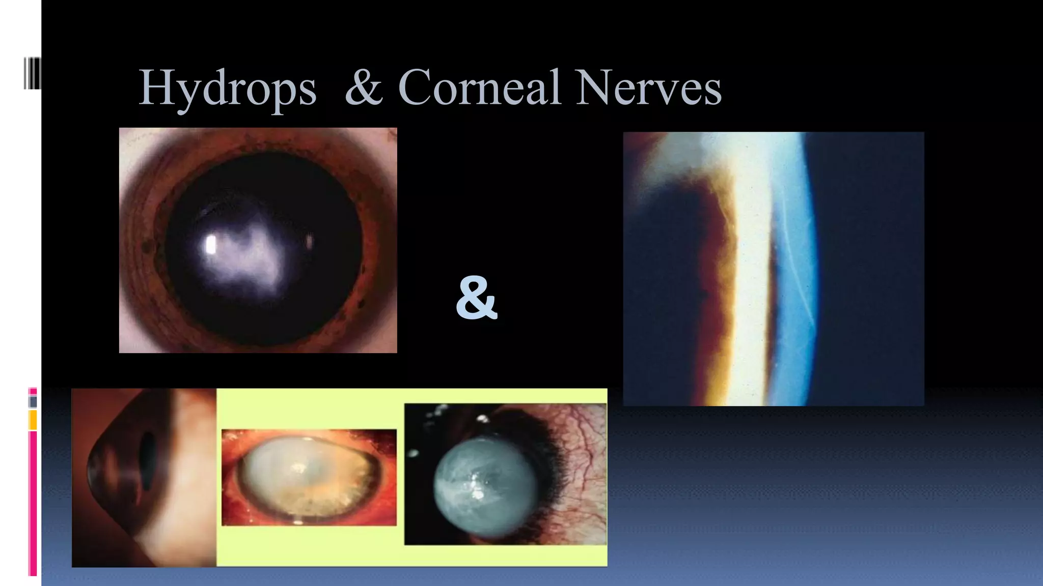 Corneal diseases | PPTX