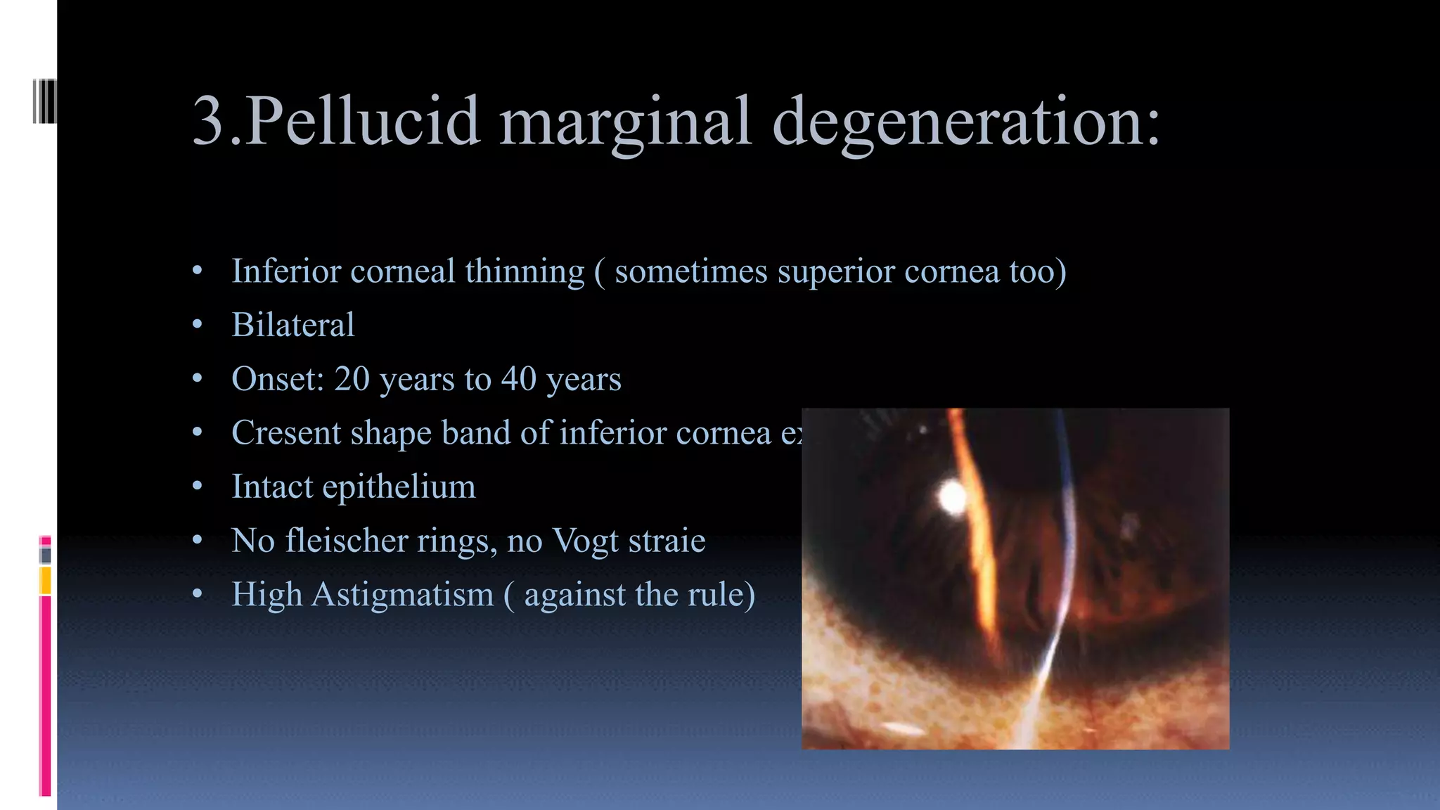Corneal diseases | PPTX
