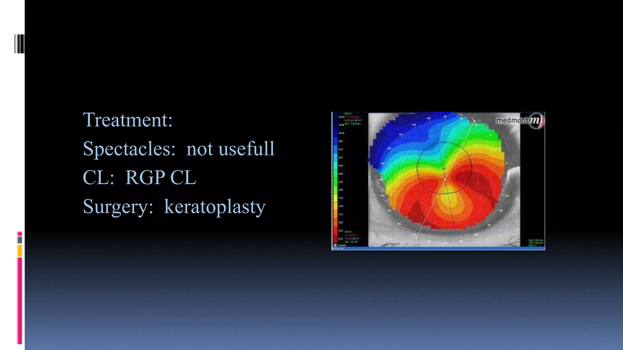 Corneal diseases | PPTX