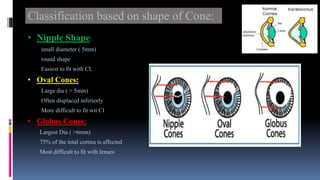 Corneal diseases | PPTX