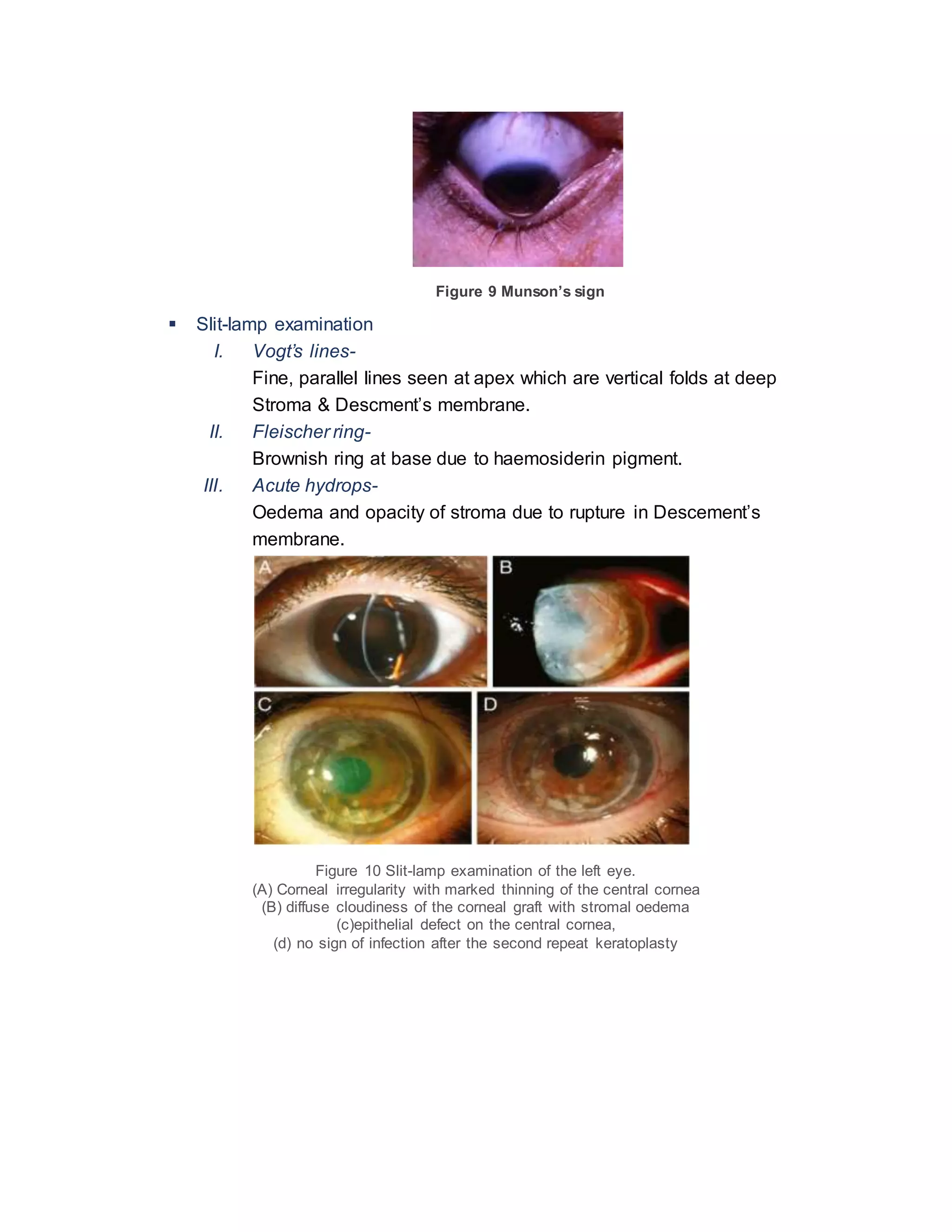 Corneal Diseases.docx