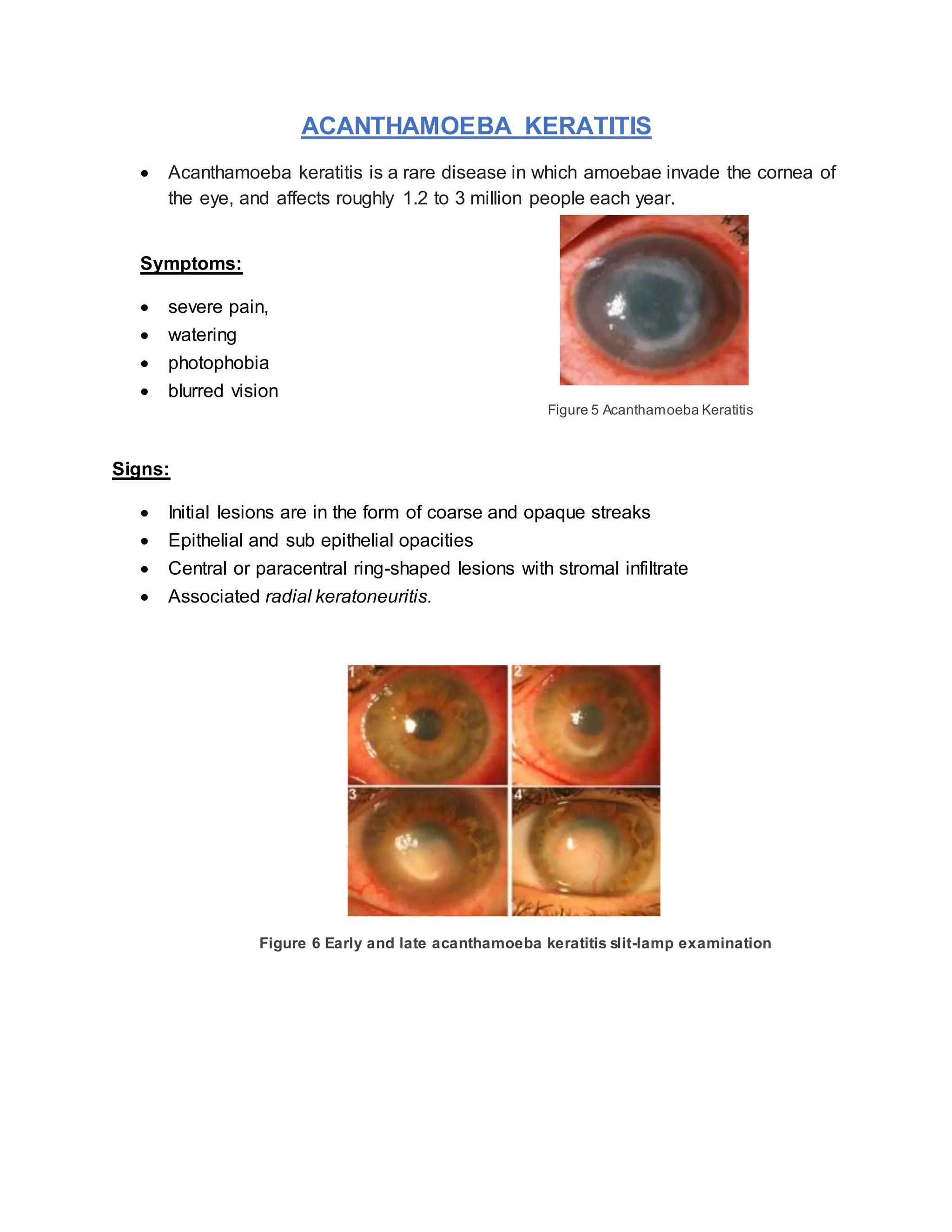 Corneal Diseases.docx