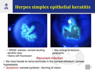 Corneal disease of the eye usmf pdf anul 4 | PDF