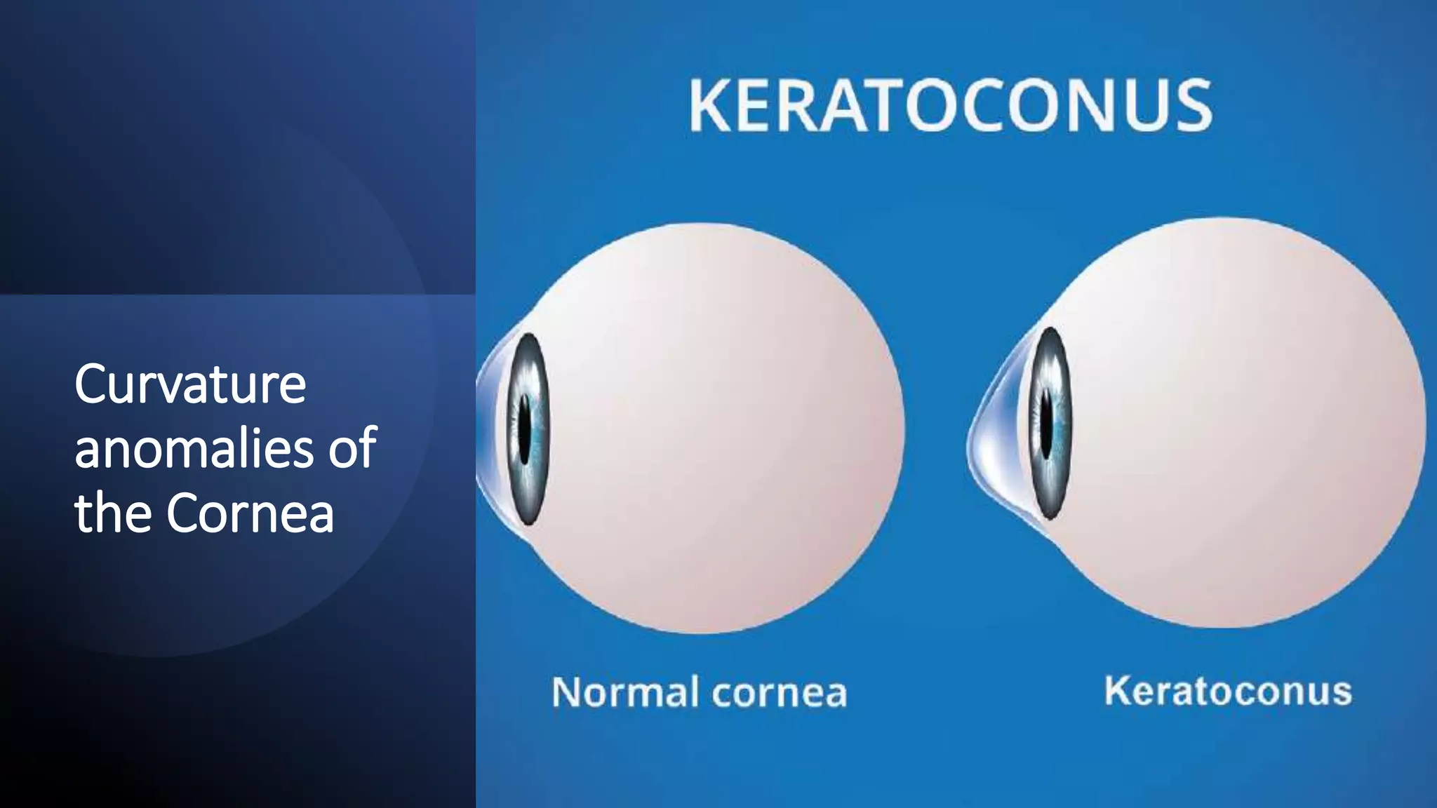 Corneal disorders part 2 | PPTX