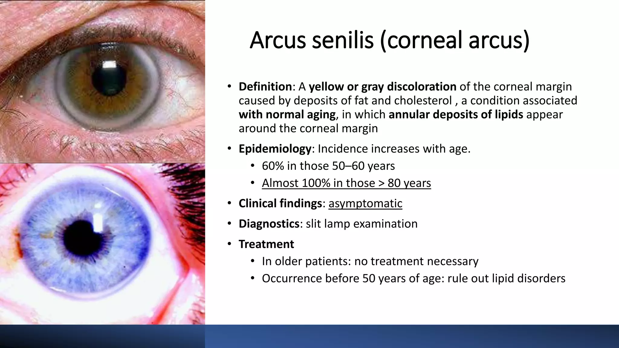 Corneal disorders part 2 | PPTX