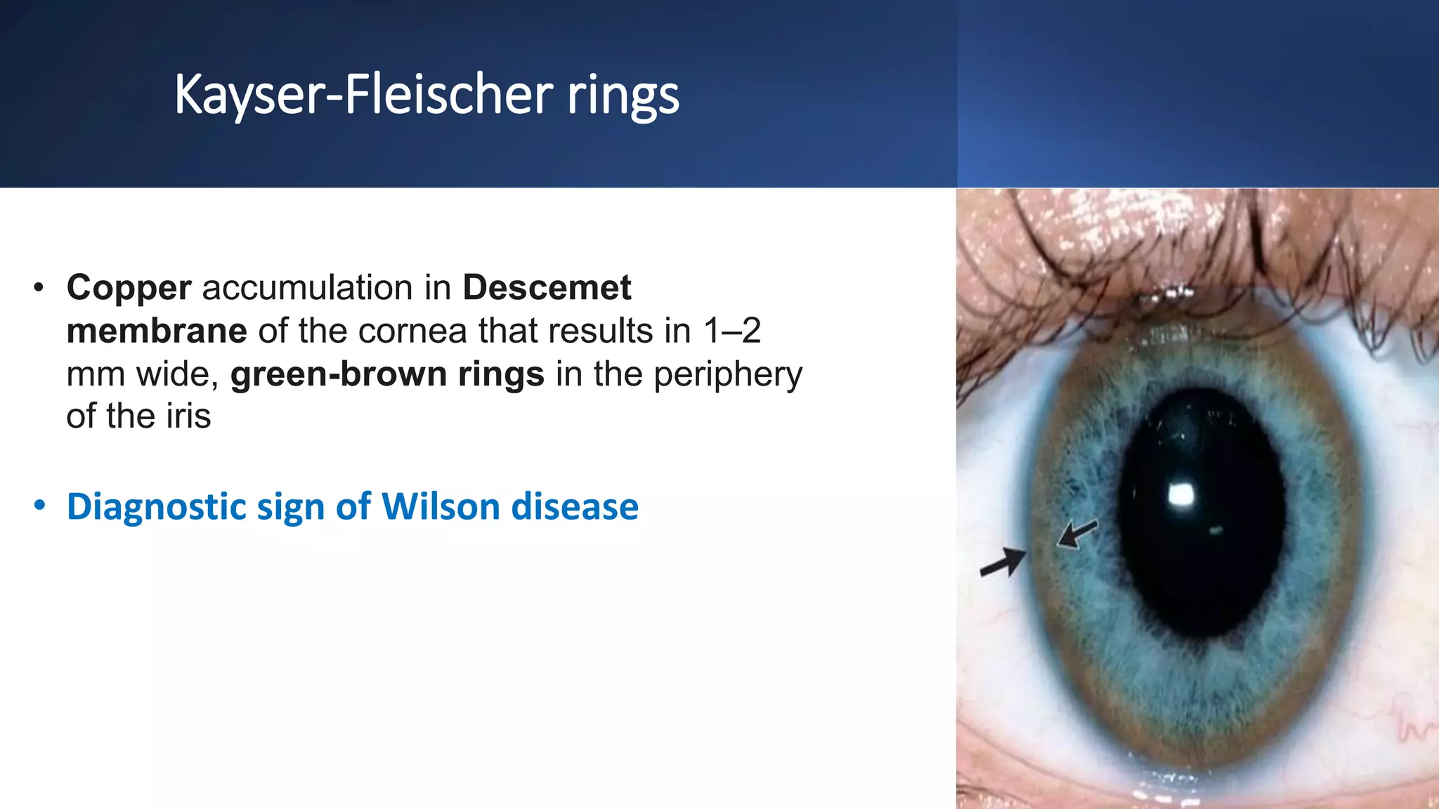 Corneal disorders part 2 | PPTX