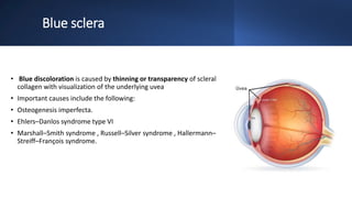 Corneal disorders part 2 | PPT