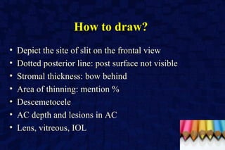 Corneal drawings | PPT
