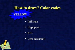 Corneal drawings | PPT