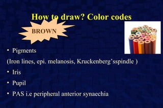 Corneal drawings | PPT