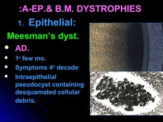 Corneal dystrophies by Dr. Safaa Refaat | PPT