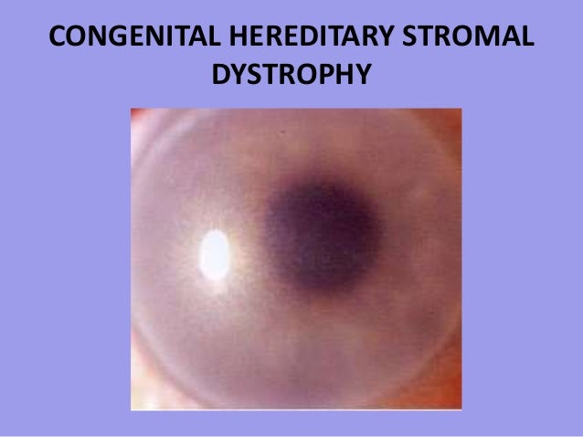 Corneal dystrophies