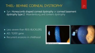 Thiel Behnke Dystrophy