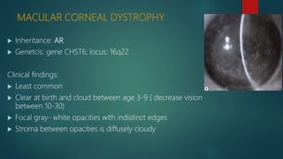 Macular Dystrophy Corneal