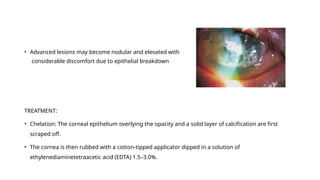 corneal dystrophies. diseases of cornea. | PPTX