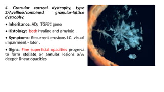 CORNEAL DYSTROPHIES AND DEGENERATIONS w IC3D classification.pptx