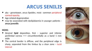 CORNEAL DYSTROPHIES AND DEGENERATIONS w IC3D classification.pptx