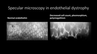 Corneal_dystrophies_&_misc.pptx