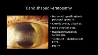Corneal_dystrophies_&_misc.pptx | Eye and Vision Conditions | Diseases ...