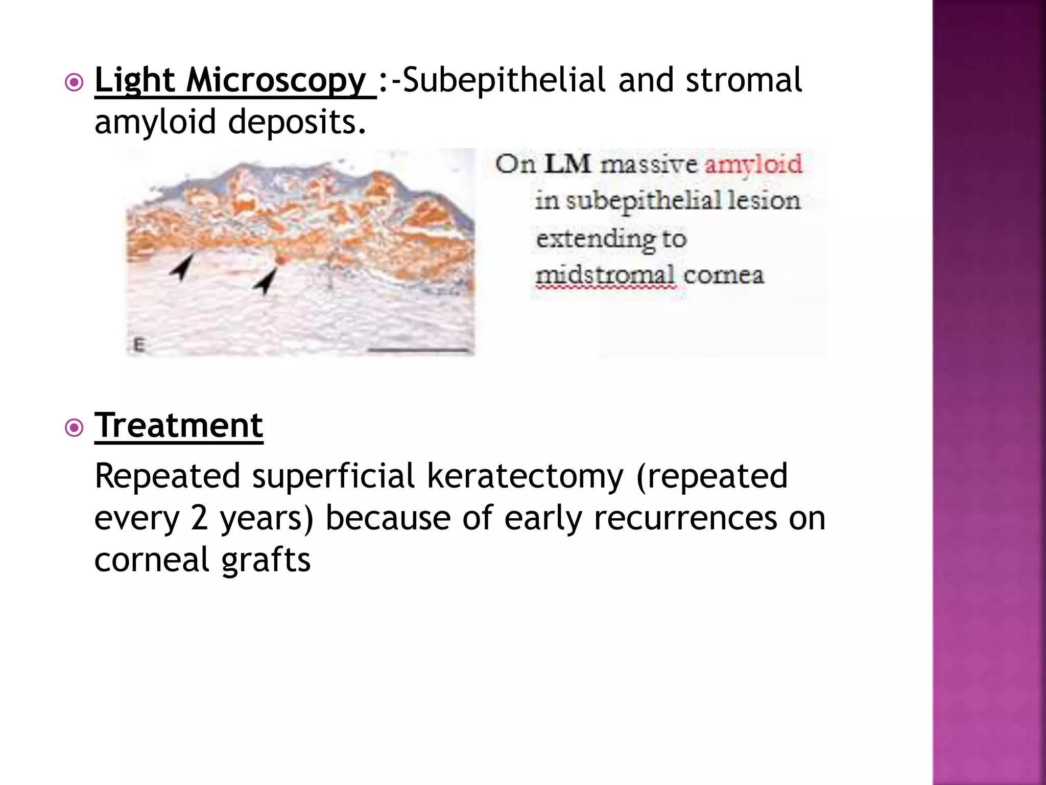 Corneal dystrophies | PPTX