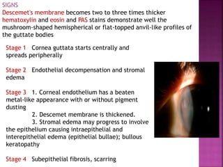 Corneal dystrophies | PPTX