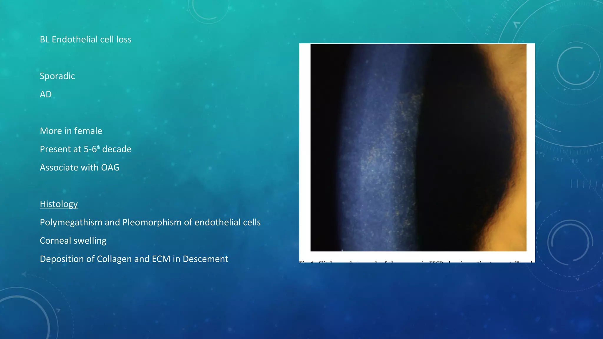 Corneal dystrophy | PPT