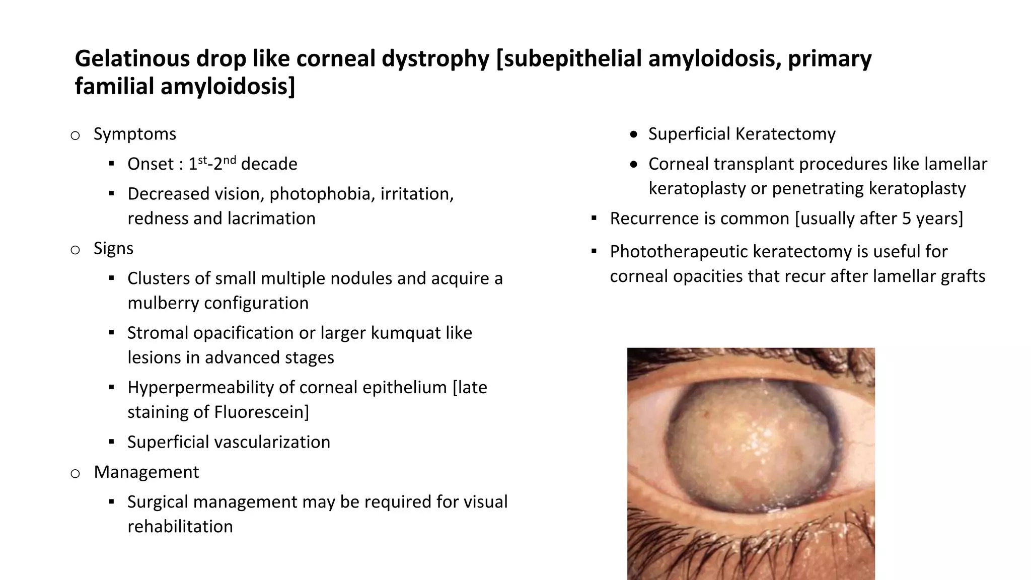 Corneal Dystrophy | PPTX