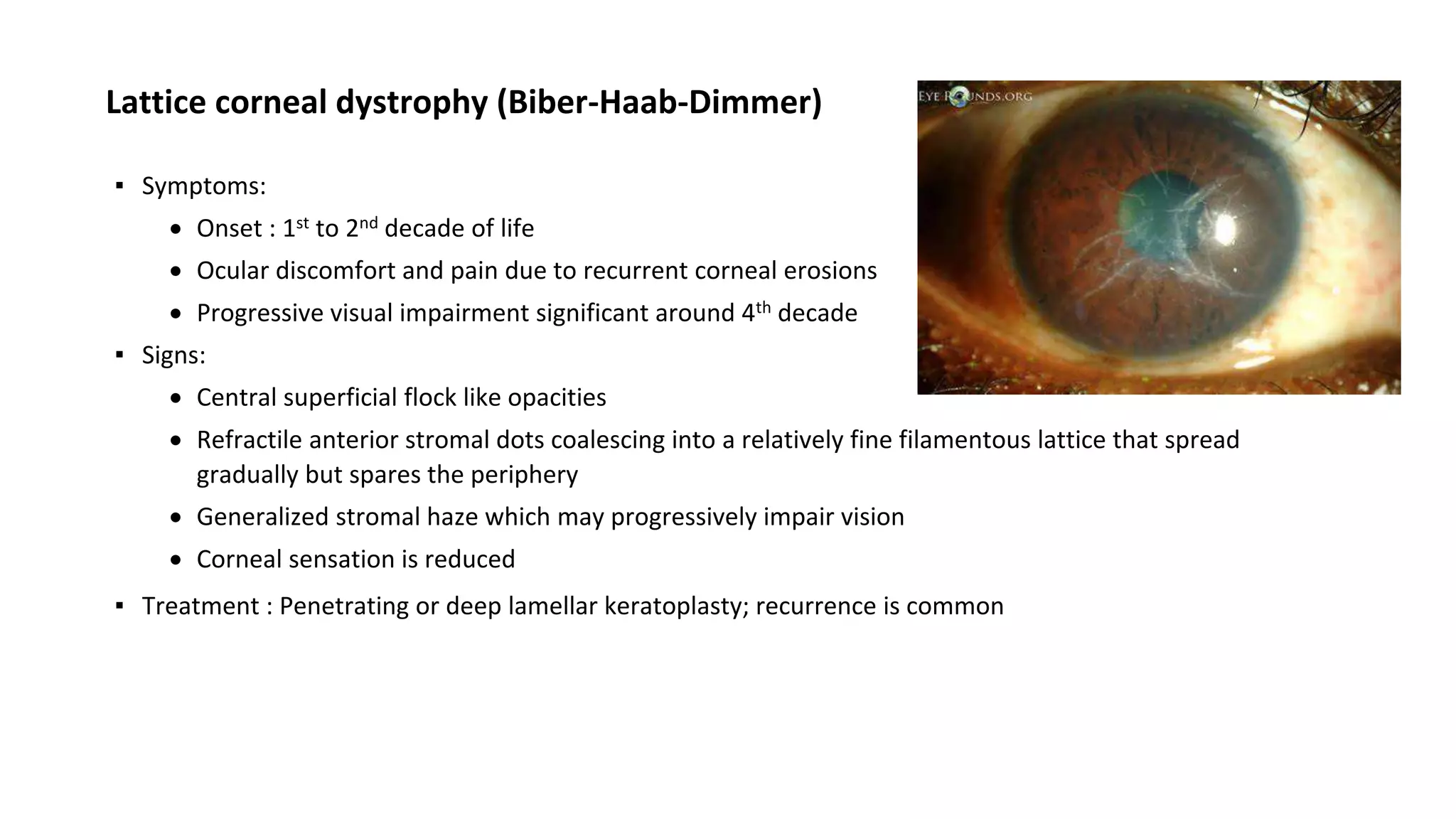 Corneal Dystrophy | PPTX
