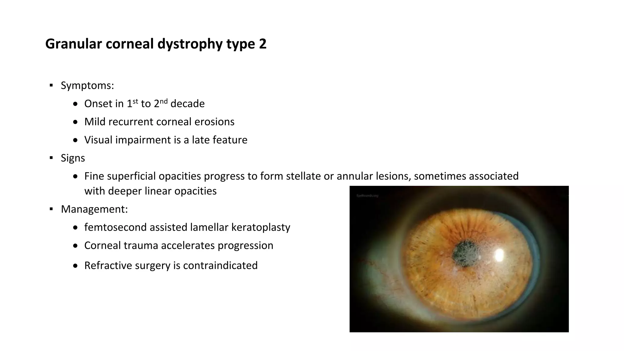 Corneal Dystrophy | PPTX