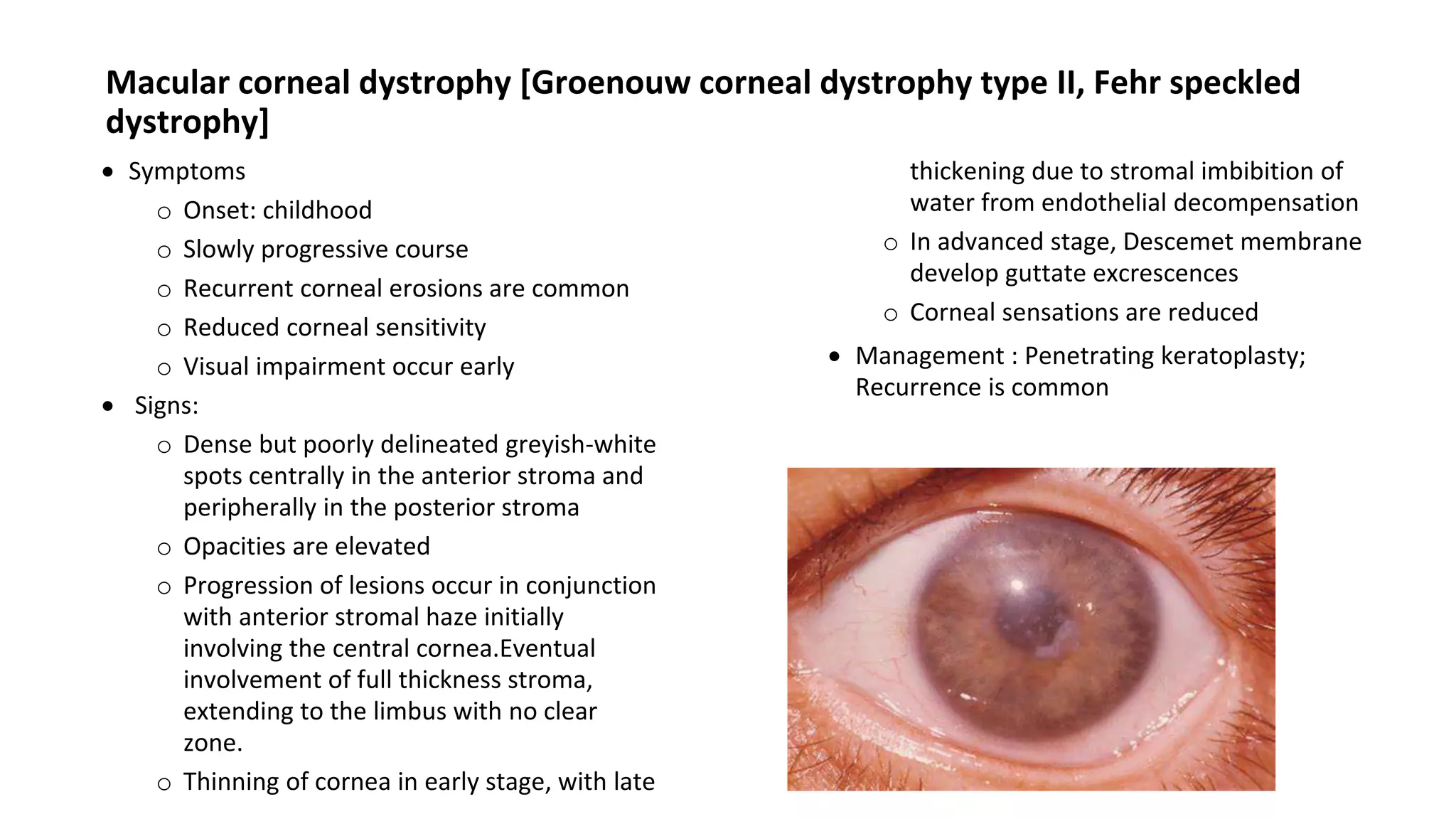 Corneal Dystrophy | PPTX