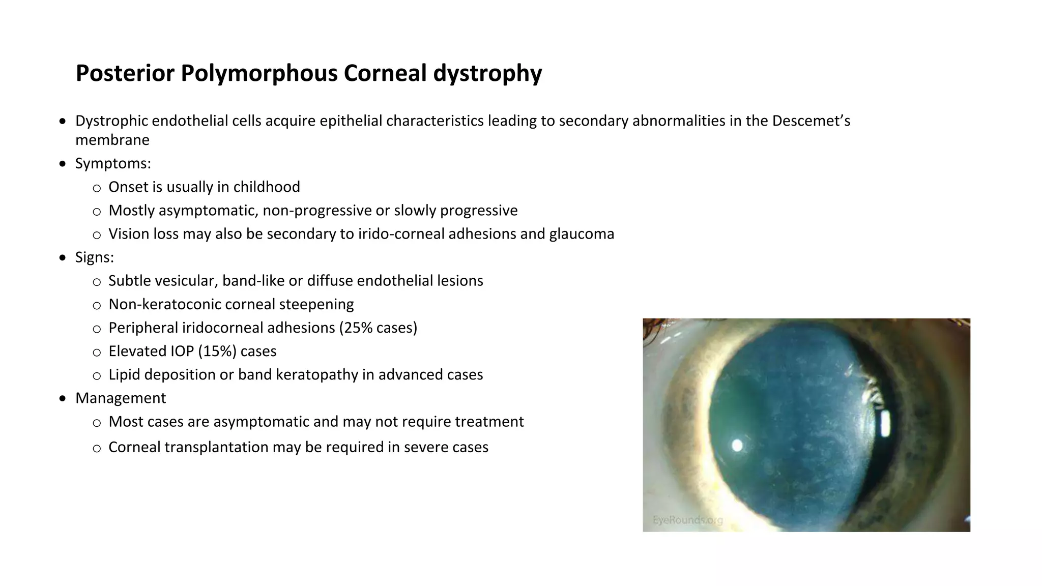 Corneal Dystrophy | PPTX