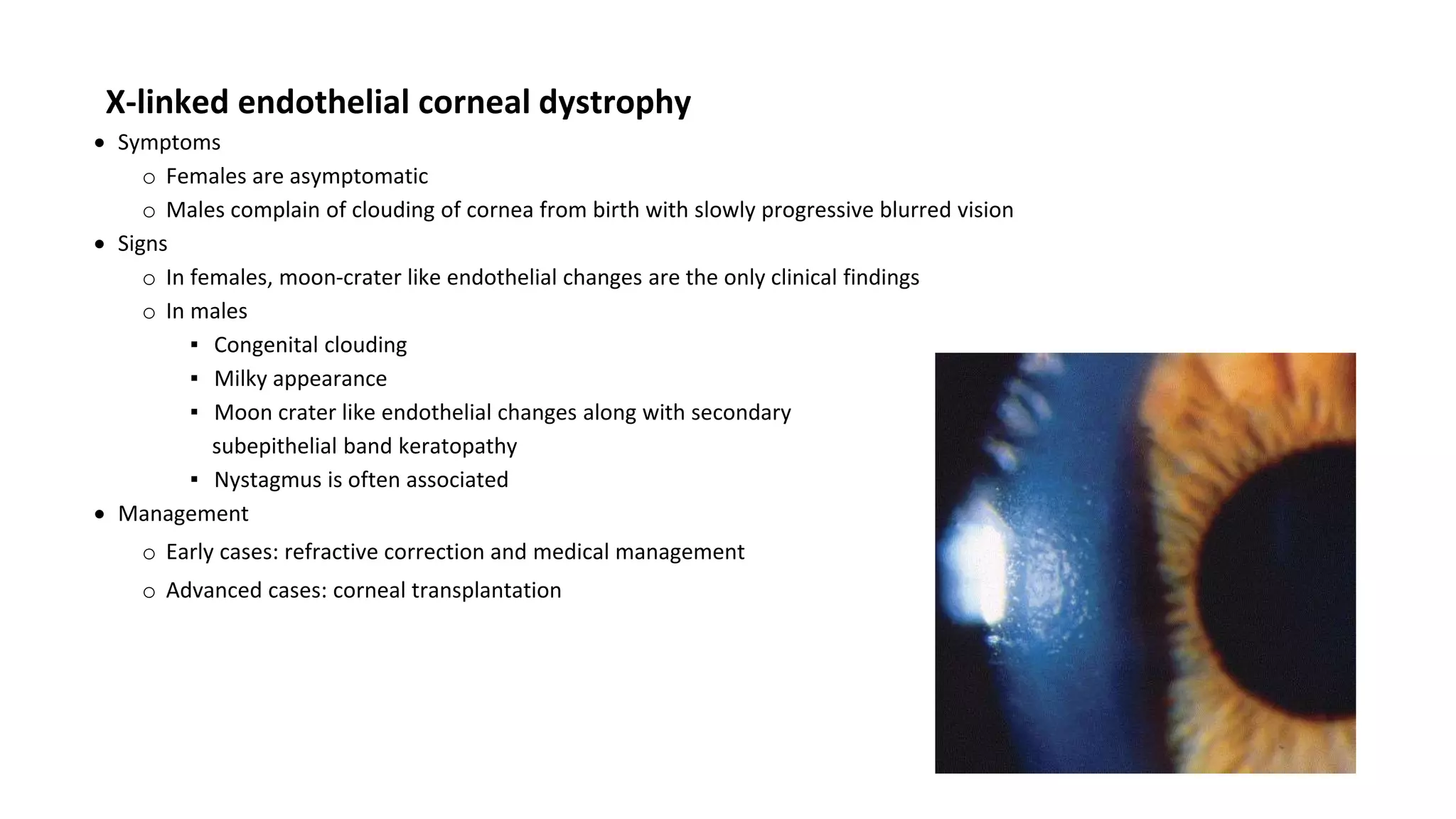 Corneal Dystrophy | PPTX