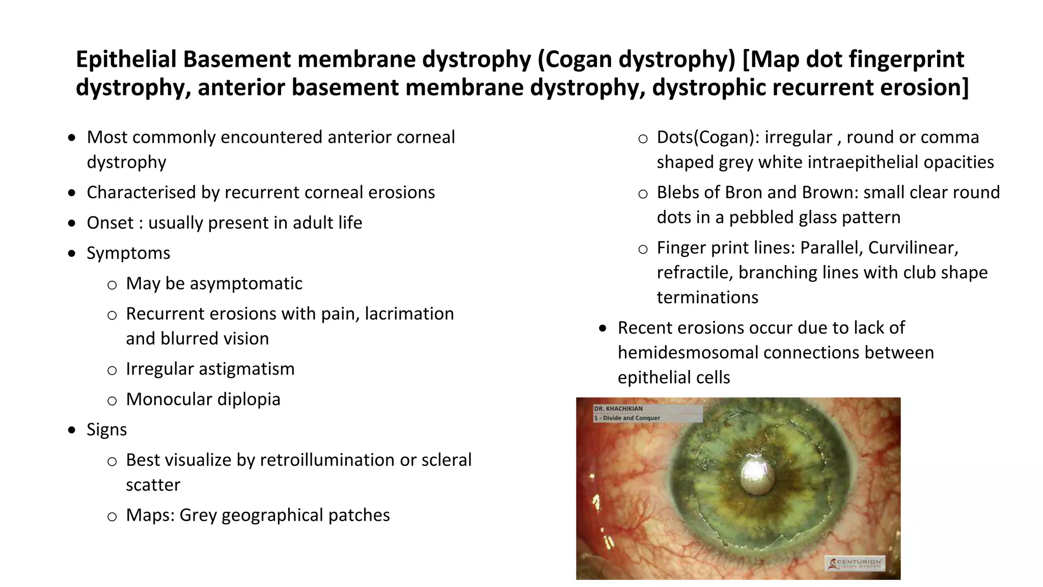 Corneal Dystrophy | PPTX | Eye and Vision Conditions | Diseases and ...