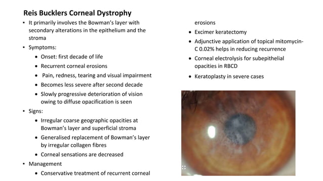 Corneal Dystrophy | PPTX | Eye and Vision Conditions | Diseases and ...
