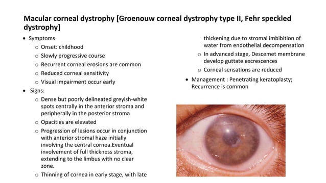 Corneal Dystrophy | PPTX | Eye and Vision Conditions | Diseases and ...